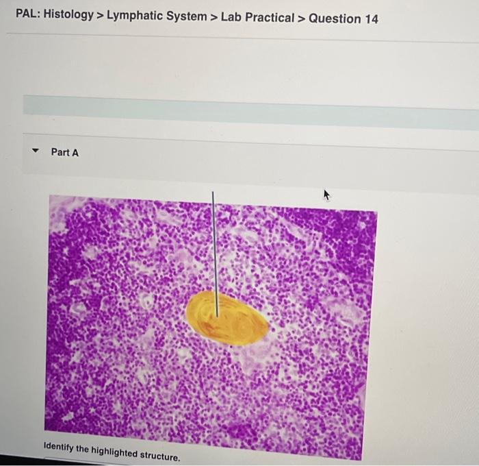 Solved PAL: Histology > Lymphatic System > Lab Practical > | Chegg.com