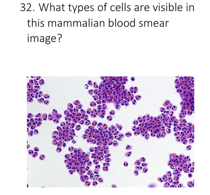 Solved 32. What types of cells are visible in this mammalian | Chegg.com