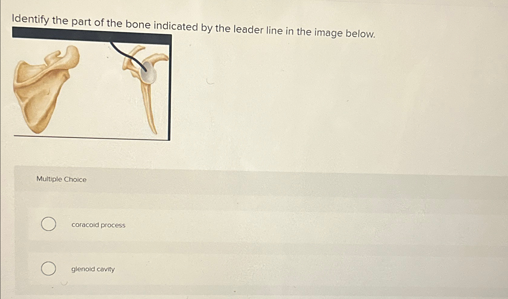 Solved Identify the part of the bone indicated by the leader | Chegg.com
