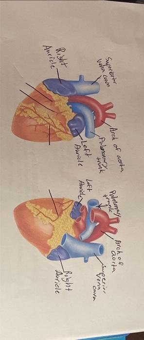 Solved label missing parts | Chegg.com
