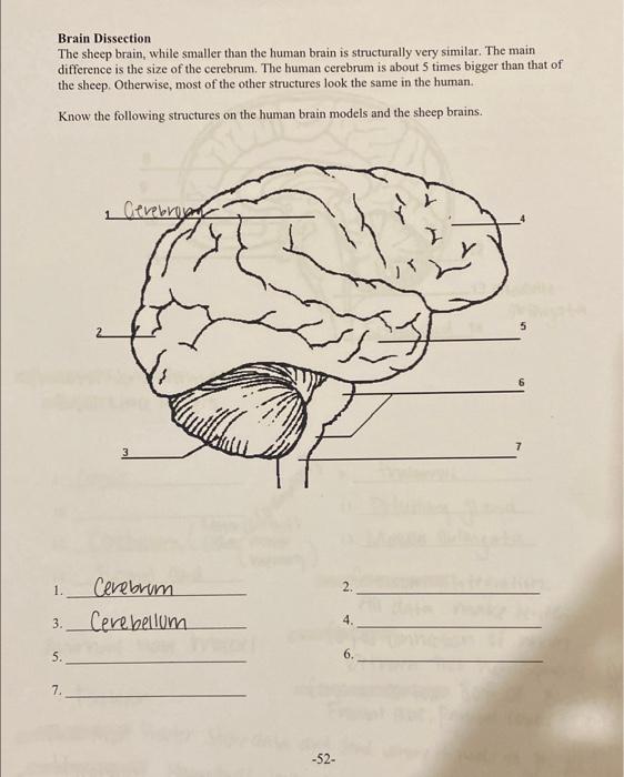 Solved Brain Dissection The sheep brain, while smaller than | Chegg.com