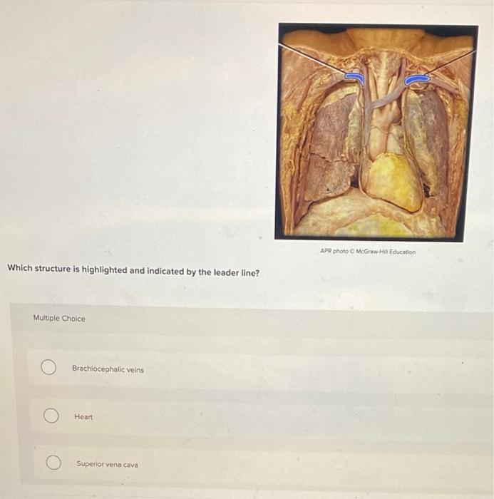 Solved APR photo McGraw-Hill Education Which structure is | Chegg.com