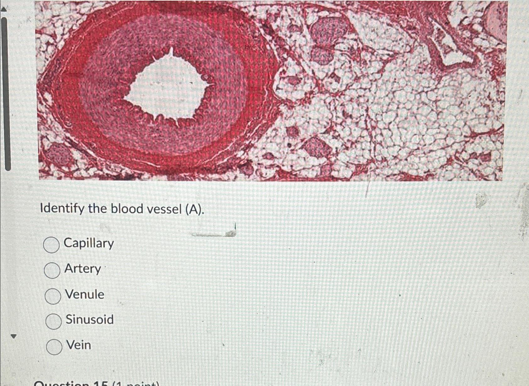 Solved Identify the blood vessel | Chegg.com