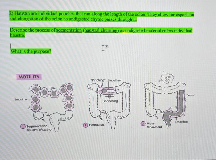 Solved 2) Haustra are individual pouches that run along the | Chegg.com