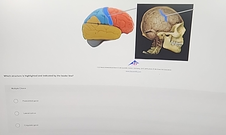 Solved Which structure is hightighted and lindic ated by the | Chegg.com