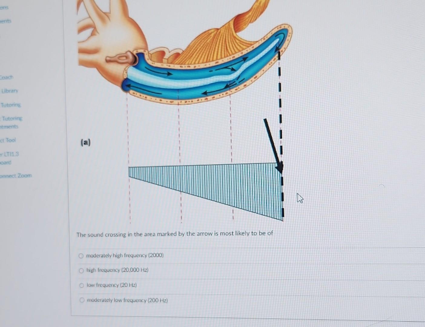 Solved The sound crossing in the area marked by the arrow is | Chegg.com