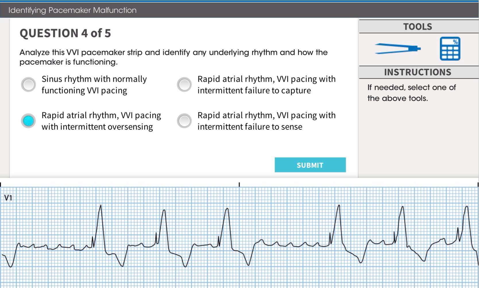 Identifying Pacemaker Malfunctionquestion 4 ﻿of 