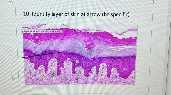 Solved 10. Identify layer of skin at arrow (be specific) | Chegg.com