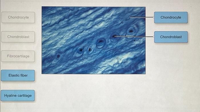 Solved Chondrocyte Chondrocyte Chondroblast Chondroblast | Chegg.com