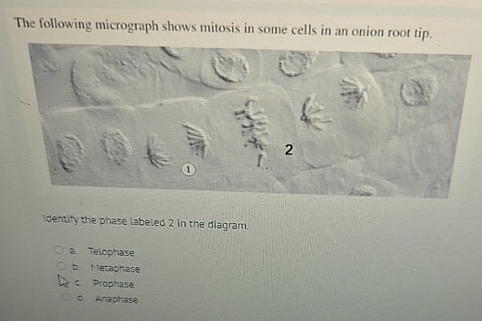 Solved The following micrograph shows mitosis in some cells | Chegg.com