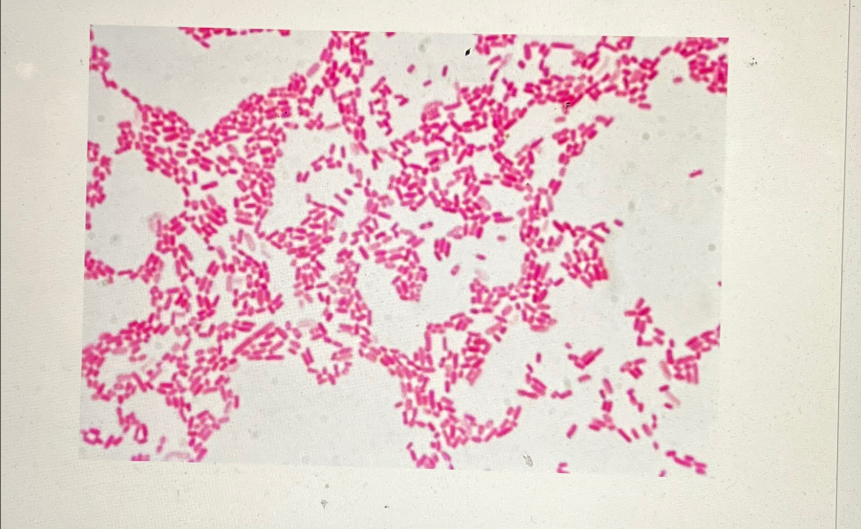 Solved Is this sample E.coli or Entercoccus faecalis? | Chegg.com