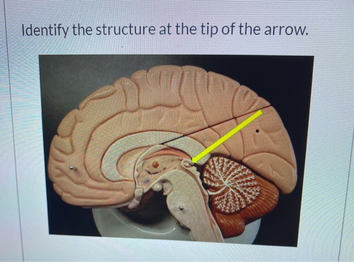 Solved Identify the structure at the tip of the arrow. | Chegg.com