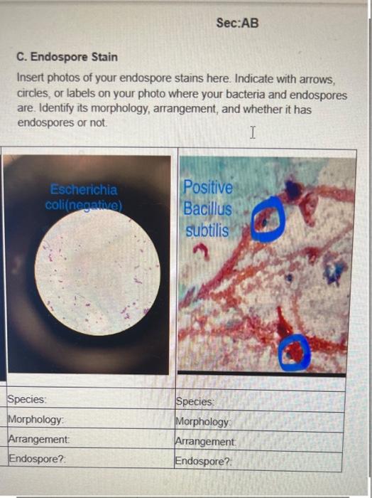 Solved A. Capsule Stain Insert photos of your capsule | Chegg.com