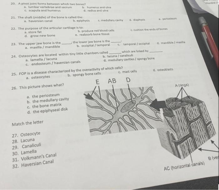 Solved 20. A pivot joint forms between which two bones? a. | Chegg.com