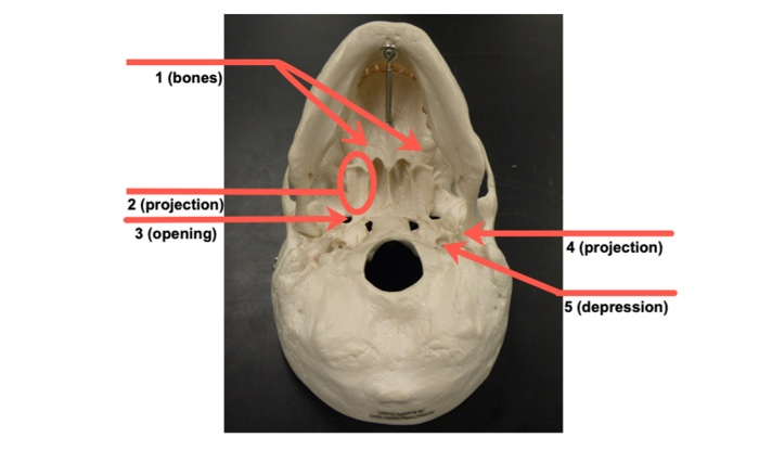 Solved 1 (bones) 2 (projection) 3 (opening) 4 (projection) 5 | Chegg.com