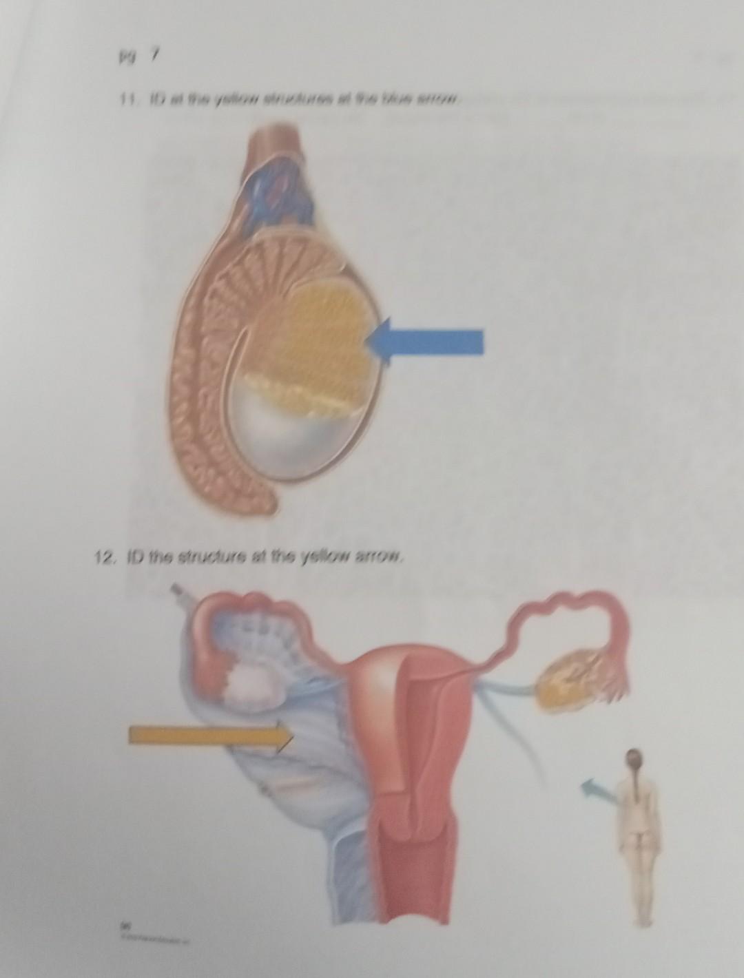 Solved \r\n12. ID the structure at the yellow arrow. | Chegg.com