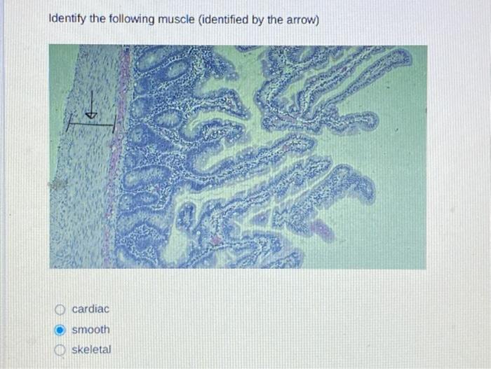 Solved 1.identify the type of muscle found within this | Chegg.com Solved 1.identify the type of muscle found within this | Chegg.com