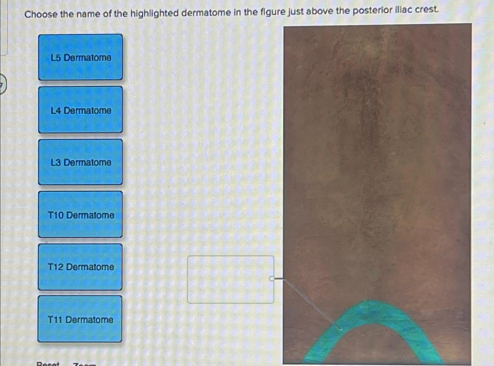Solved Choose the name of the highlighted dermatome in the | Chegg.com
