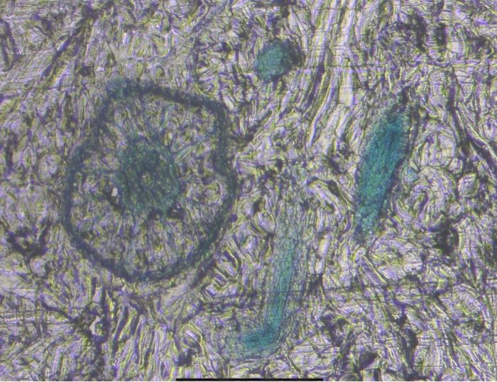where is the GUS gene trasfered to in this cross | Chegg.com