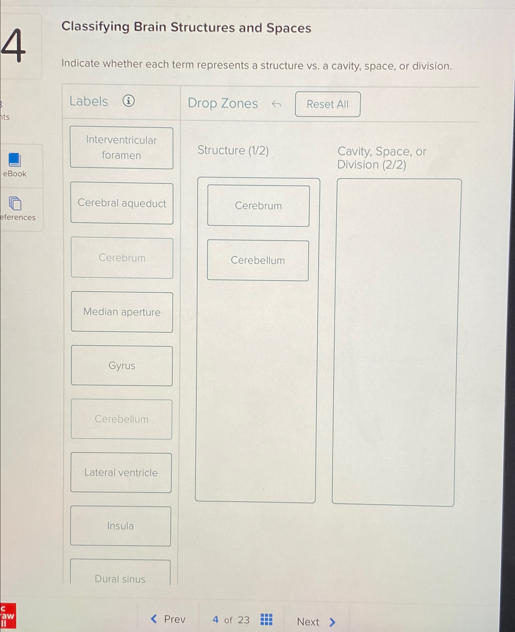 Solved Classifying Brain Structures and SpacesIndicate | Chegg.com