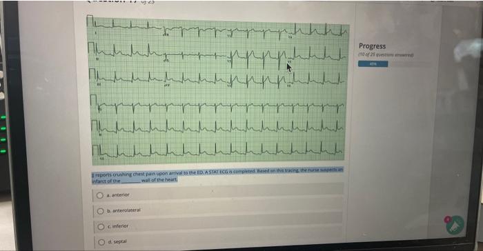 Solved JJ reports crushing chest pain upon areival to the | Chegg.com