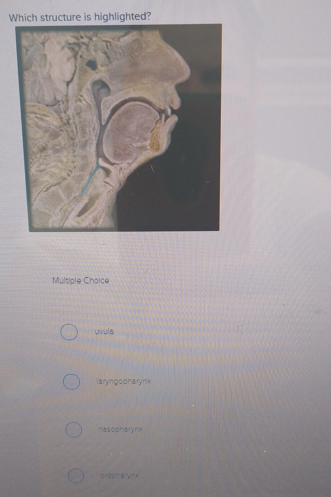 Solved Which structure is highlighted? Multiple Choice uvula | Chegg.com