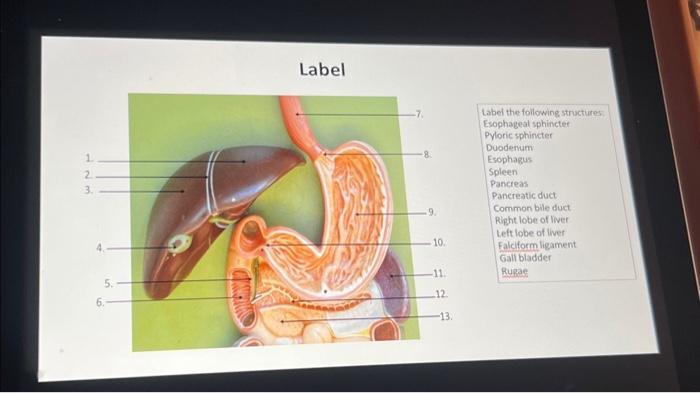 Solved Label the following structures Esophageal sphincter | Chegg.com