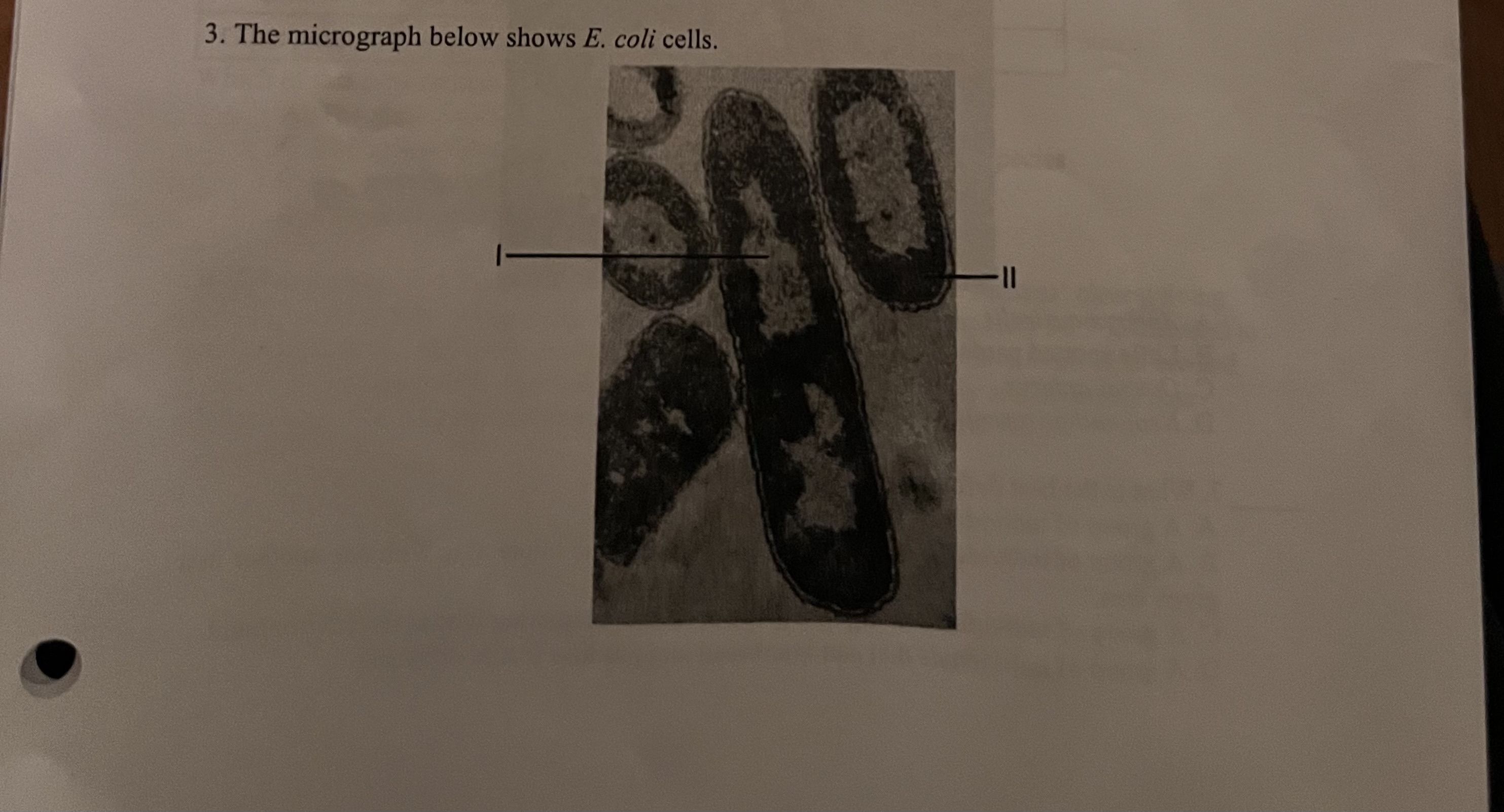 Solved TheThe micrograph below shows E. ﻿coli cells. | Chegg.com