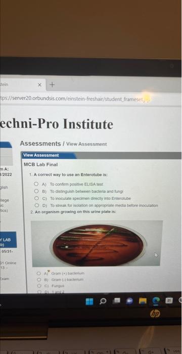 Solved 1. A correct way to use an Enterotube is: A) To | Chegg.com