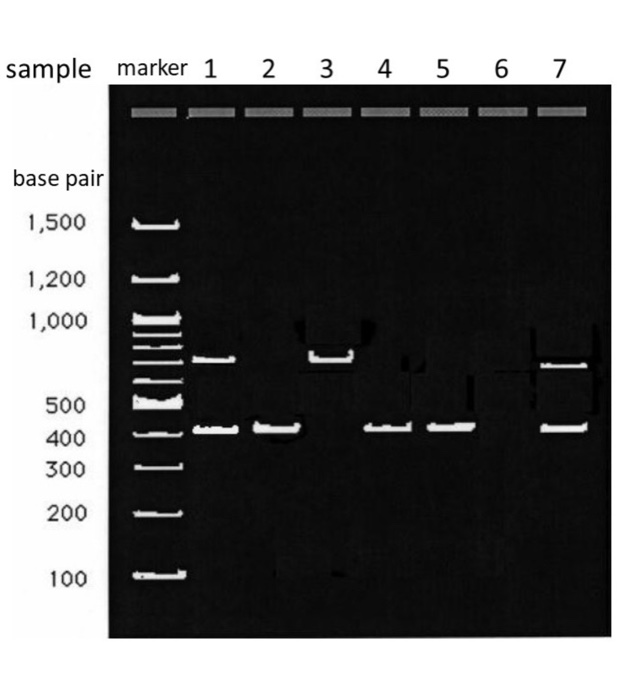 Solved Lab Assignment sample marker 1 2 3 5 6 7 base pair | Chegg.com