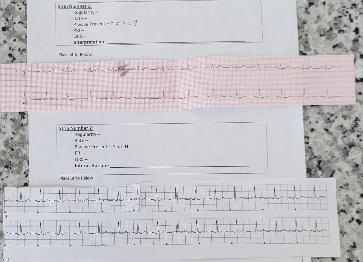 Solved could you please help me with my ekg interpretation. | Chegg.com