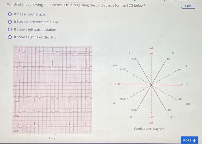 Solved Which of the following statements is true regarding | Chegg.com