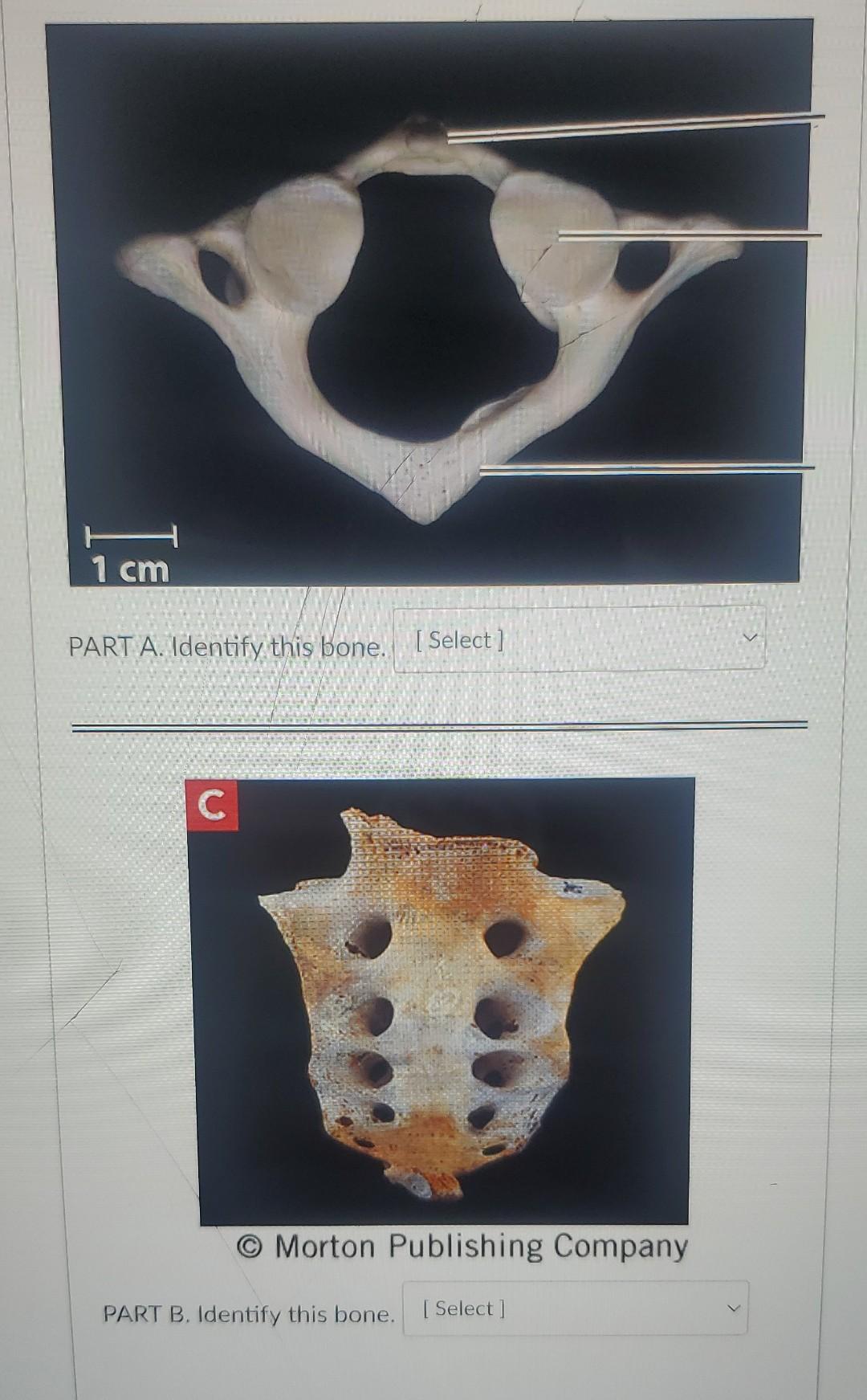 PART A. Identify this bone. (c) Morton Publishing | Chegg.com