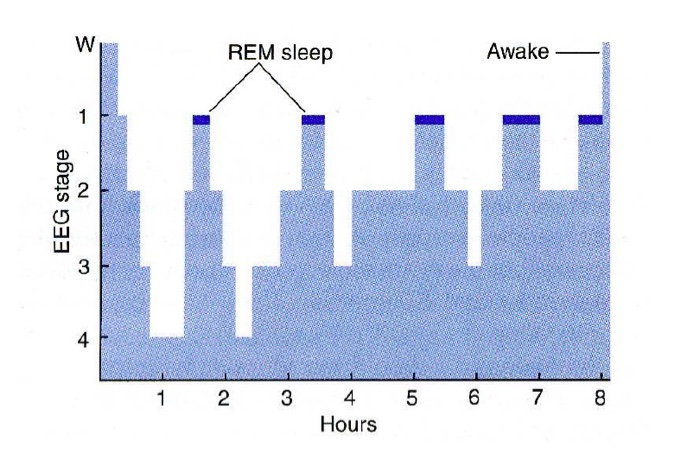 Solved 1) EEG can be used to measure the stages of sleep. On | Chegg.com