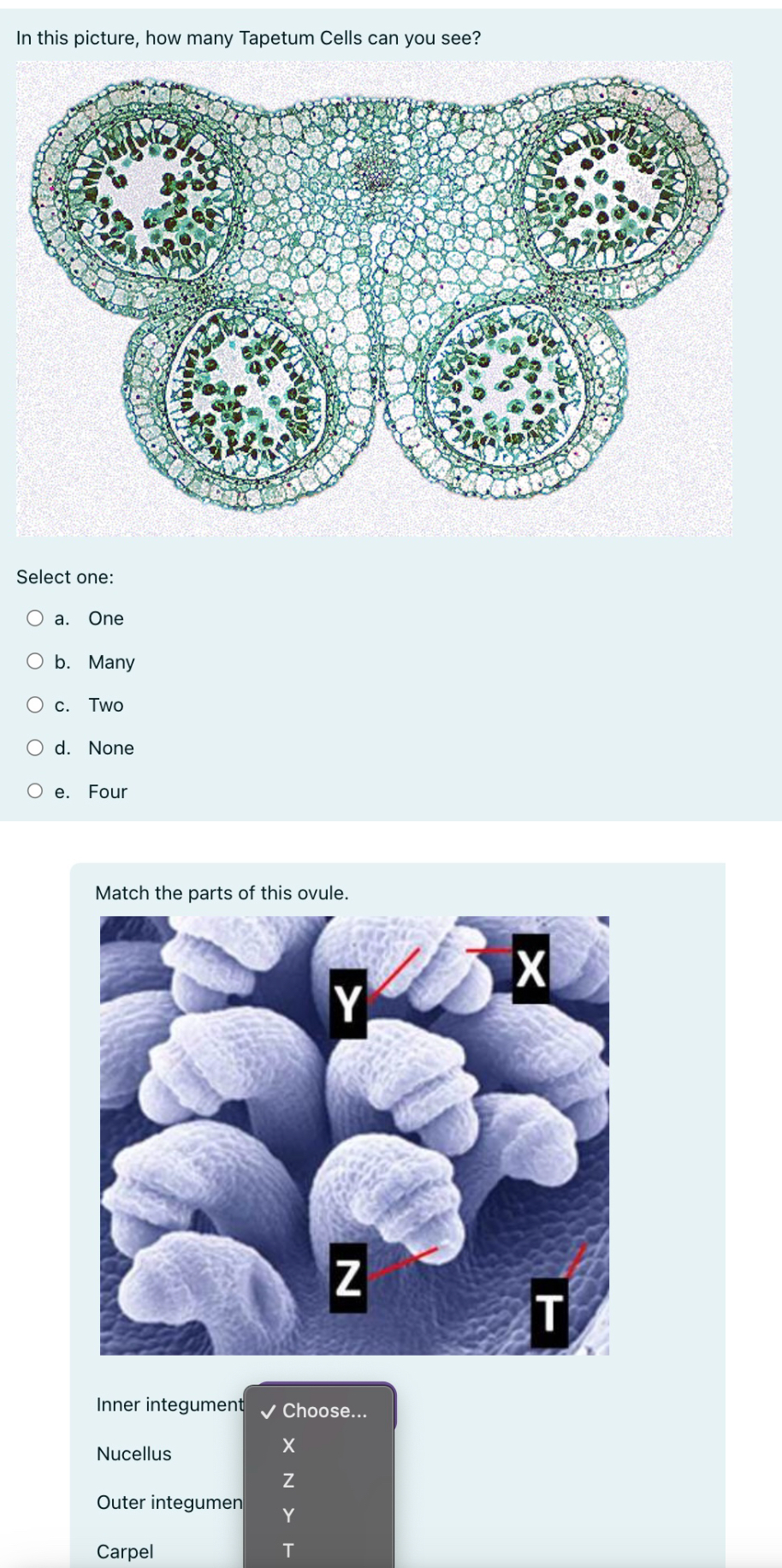 Solved In this picture, how many Tapetum Cells can you | Chegg.com