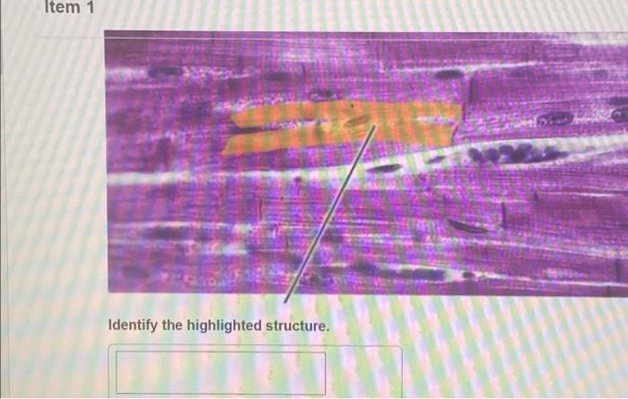Solved Identify the highlighted structure. | Chegg.com