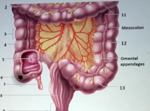 Solved 2 11 Mesocolon 12 Omental appendages 13 8 | Chegg.com