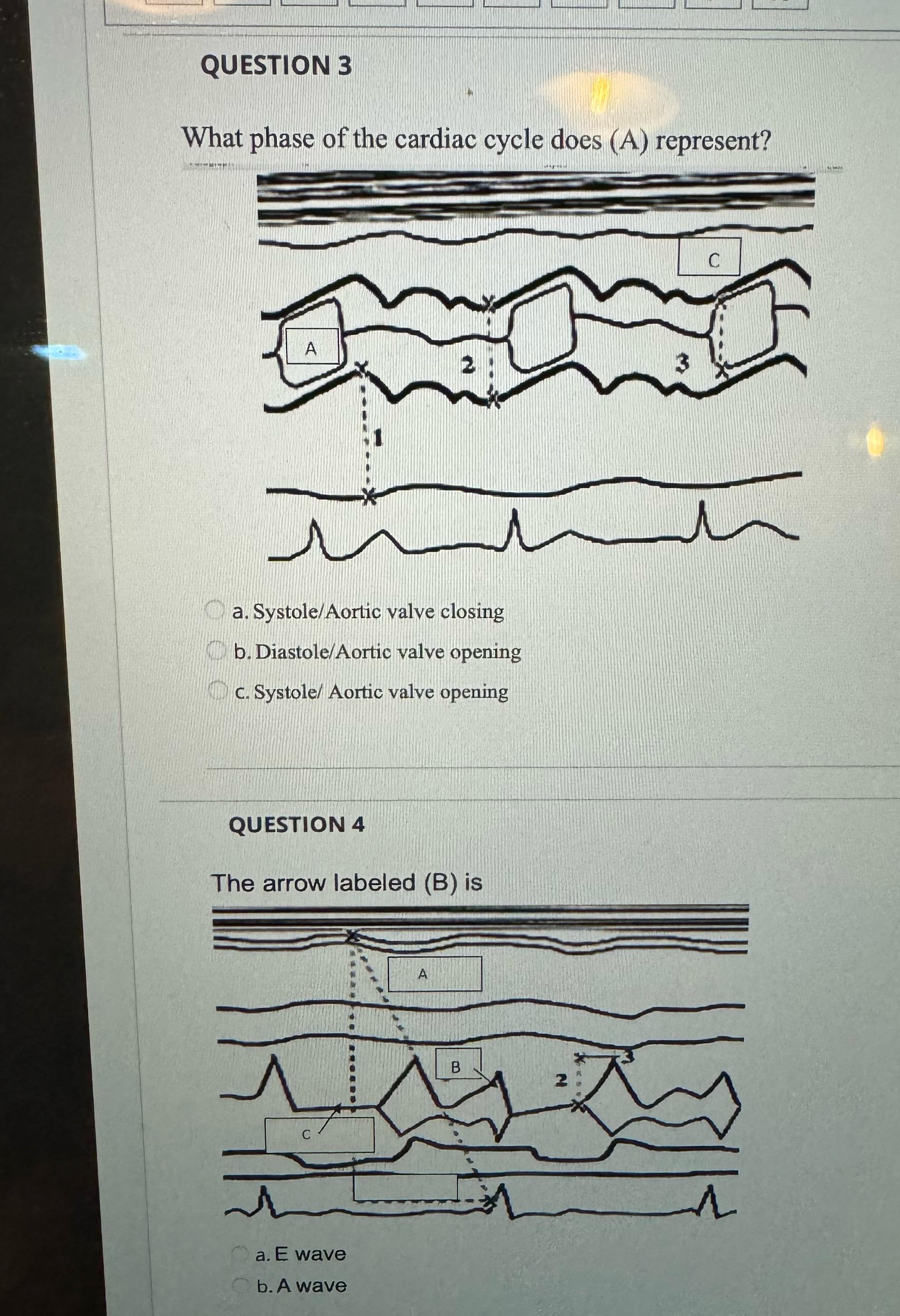Solved ONLY ANSWER, NO EXPLANATIONQUESTION 3What phase of | Chegg.com