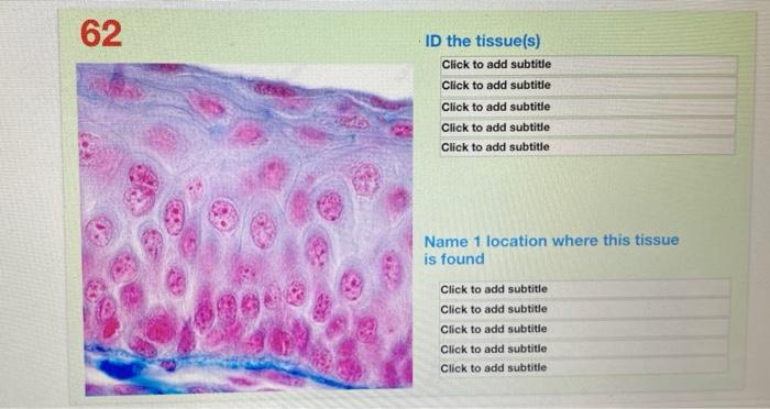Solved ID the tissue(s) Name 1 location where this tissue is | Chegg.com