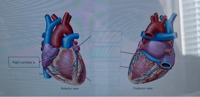 Solved Label the coronary vessels of the heart in the | Chegg.com