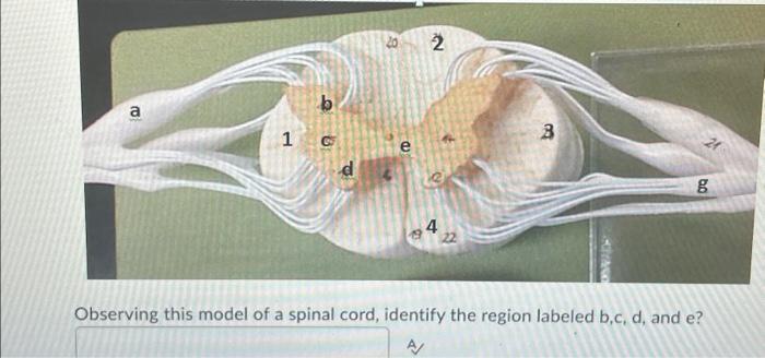 Solved Observing this model of a spinal cord, identify the | Chegg.com