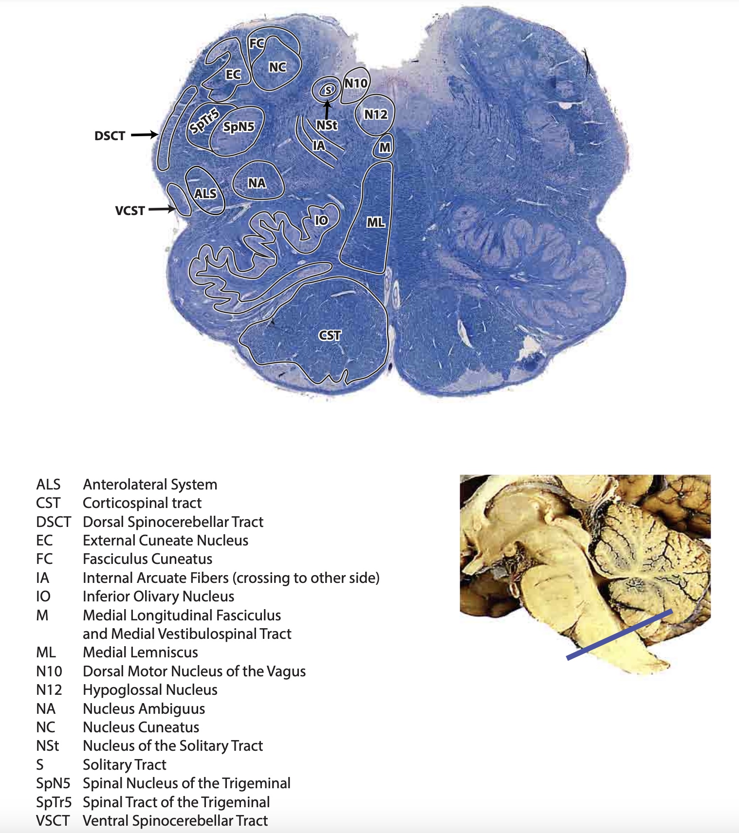 Solved What part of the medulla is this (is it rostral)?ALS | Chegg.com