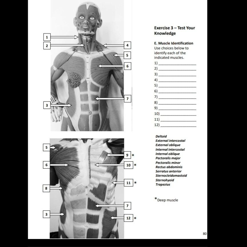 Solved Exercise 3 - Test Your Knowledge E. Muscle | Chegg.com