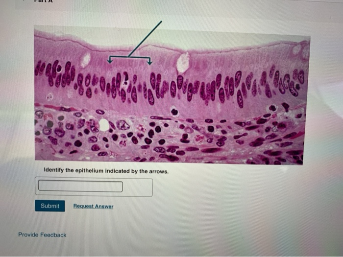 Solved FALA Identify the epithelium indicated by the arrows. | Chegg.com