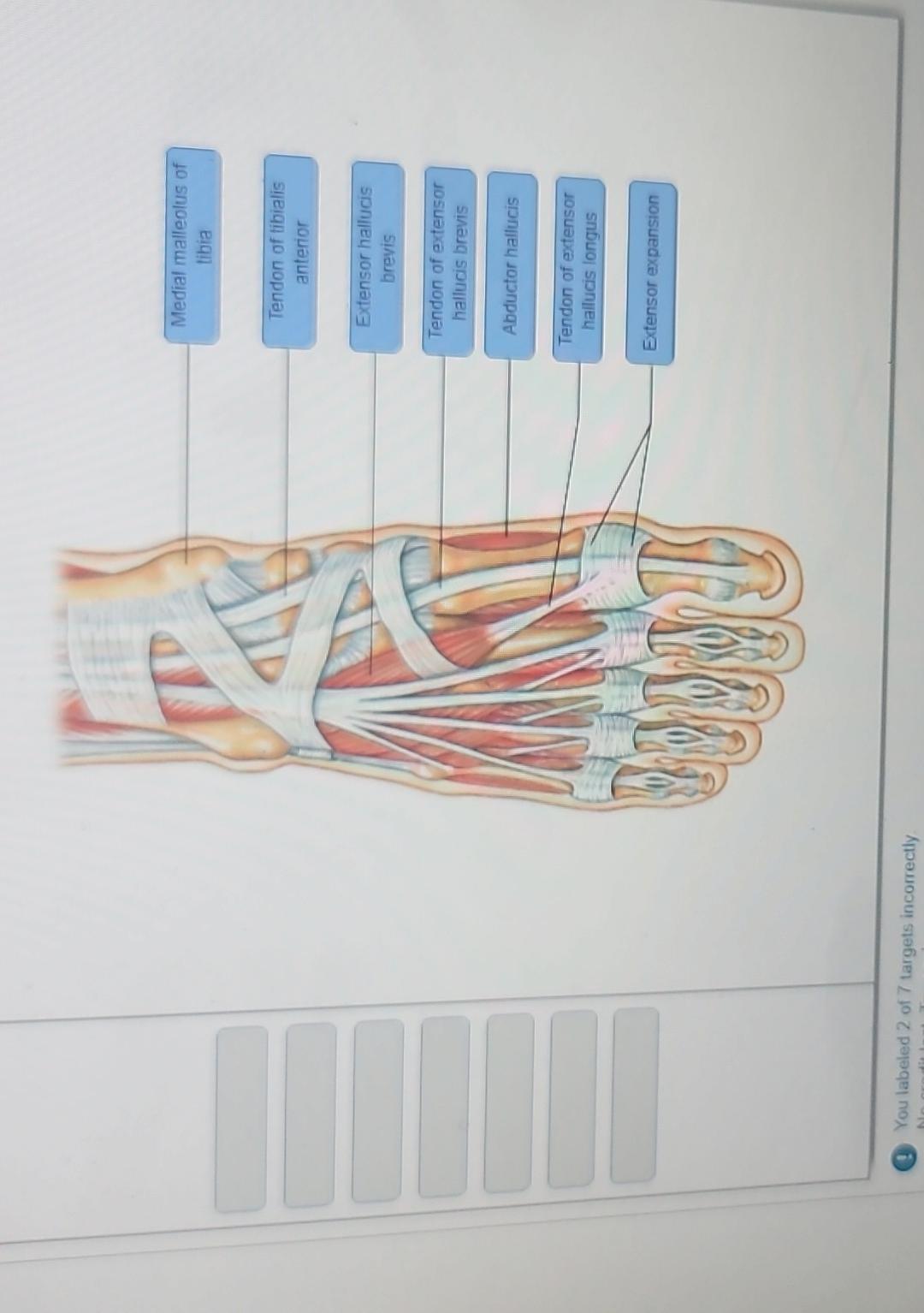 Solved I'm not sure why this is incorrect | Chegg.com