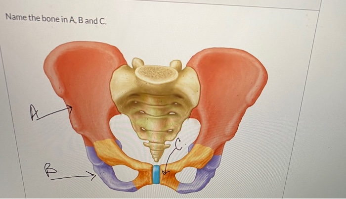 Solved Name the bone in A, B and C. | Chegg.com
