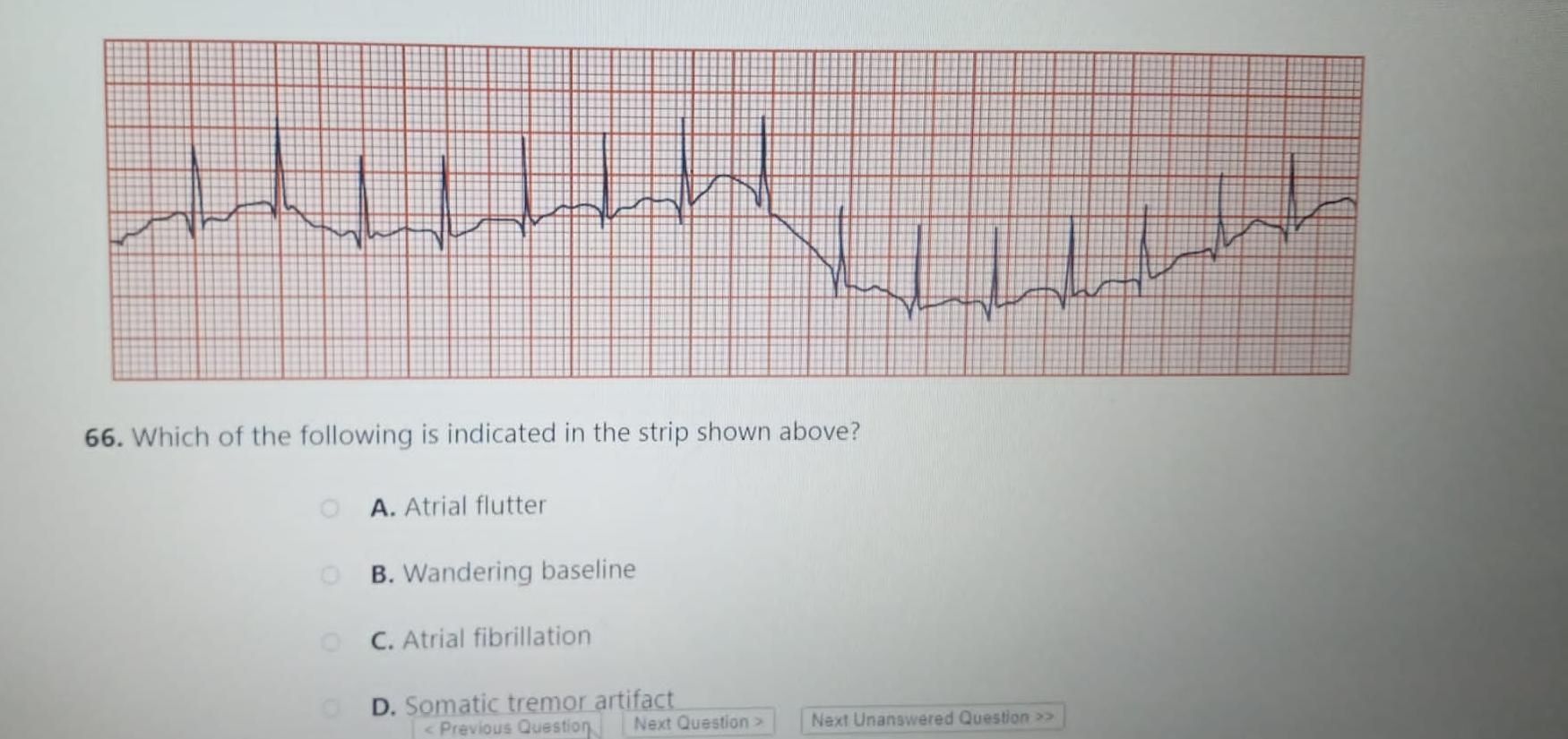 Solved Which of the following is indicated in the strip | Chegg.com