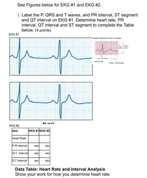 Solved See Figures below for EKG #1 and EKG #2. 1. Label the | Chegg.com