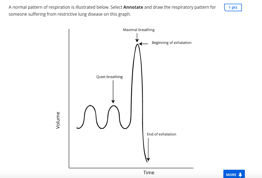 Solved A normal pattern of respiration is illustrated below. | Chegg.com