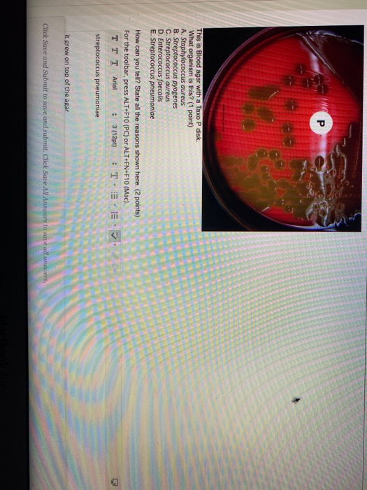 Solved P - This is Blood agar with a Taxo P disk. What | Chegg.com